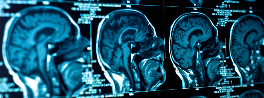 Projects | Affective Neuroscience Laboratory at University of Wisconsin ...